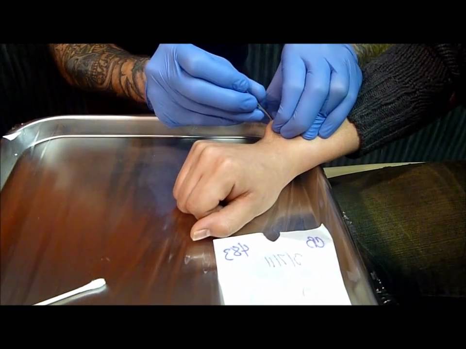 Wrist Dermal
