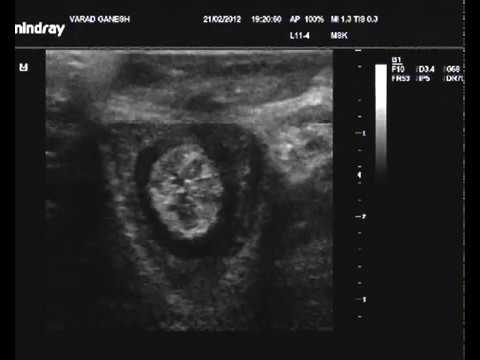 ANAL SPHINCTER