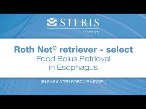 ROTH NET™ Retriever - Select | Food Bolus Retrieval in Esophagus