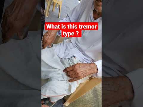 What is this tremor type ? Dr Sai Chandra