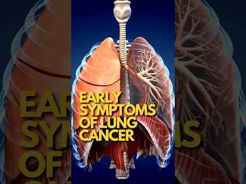 Early symptoms of Lung Cancer | Dr Jamal A Khan