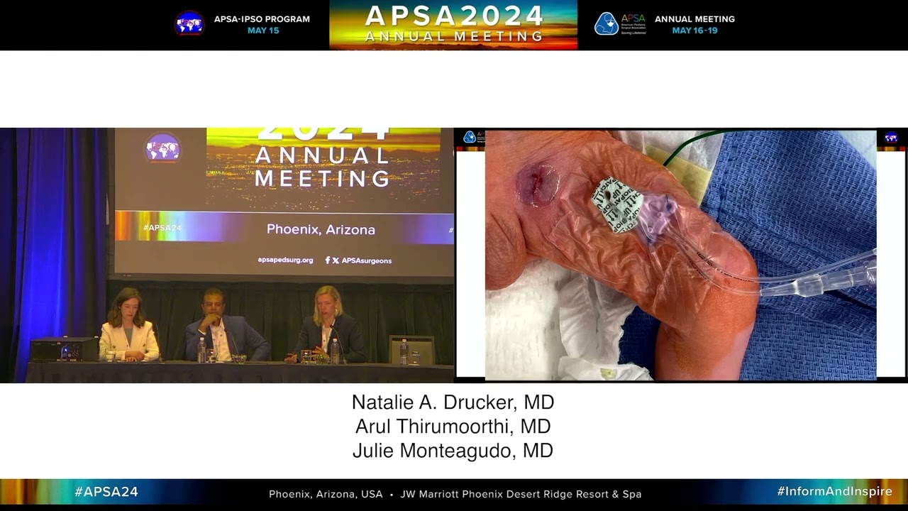 Vascular Access in Neonates and Infants: Techniques You Know and Those You Want to Know