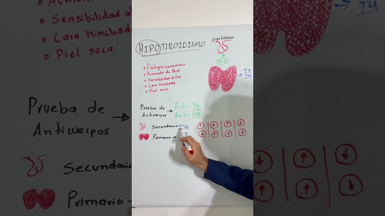 Thyroid profile interpretation #thyroid #hypothyroidism #health