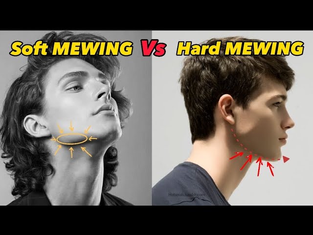 Soft MEWING Vs Hard MEWING | Correct Way For Sharp Jawline - Video ...