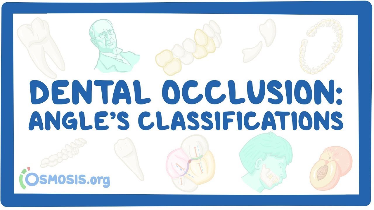 Dental occlusion - Angle’s classifications