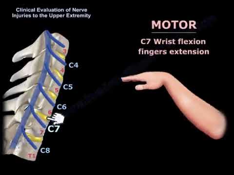 Disc Herniation Affecting C7 Nerve Root • Video • MEDtube.net