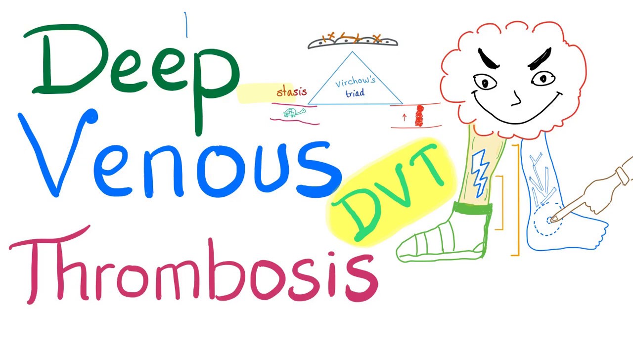 DVT/Clotting Disorder - Med طب