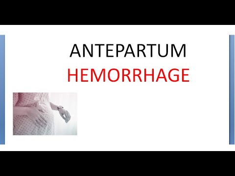 Obstetrics 304 AntePartum Hemorrhage Definition Define APH Causes Bleeding during pregnancy