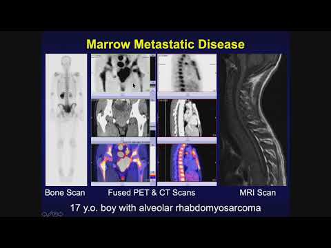 2020 PET/CT Imaging