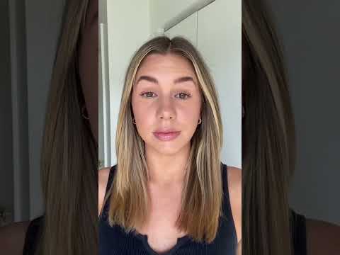 The Result of Baby Botox | Botox Forehead Results