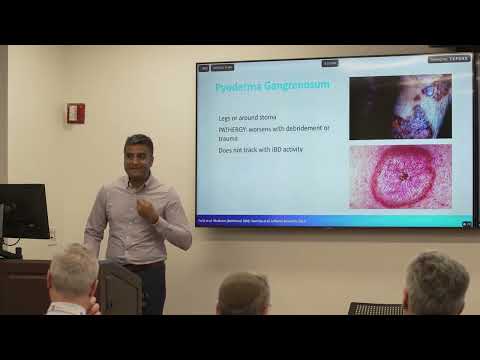 Session 4, Hot Topic Extraintestinal Manifestations of Inflammatory Bowel Disease