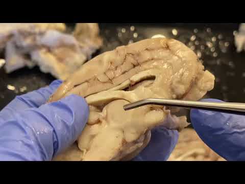 Sheep brain dissection - sagittal view