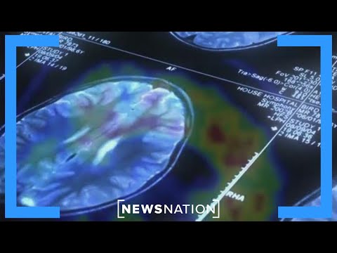 How does Donanemab compare to other Alzheimer's drugs? | Morning in America