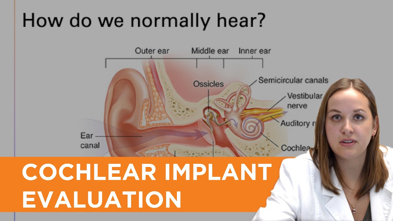 What to Expect at your Cochlear Implant Candidacy Evaluation (captioned)