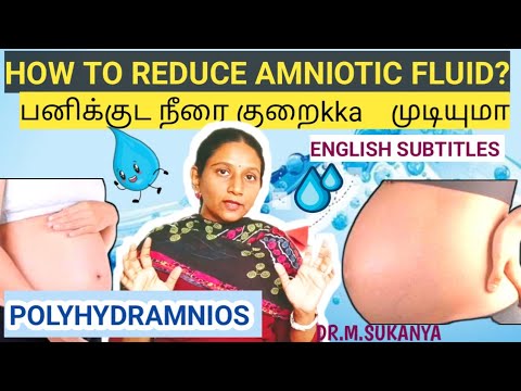 பணிக்குட நீரை குறைkka முடியுமா? POLYHYDRAMNIOS in Tamil by Dr.M.Sukanya