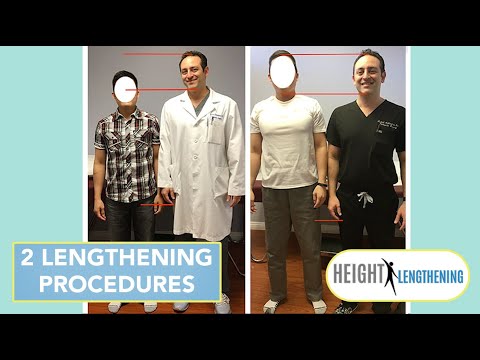 Recovering from a Double Limb Lengthening Procedure | Height Lengthening