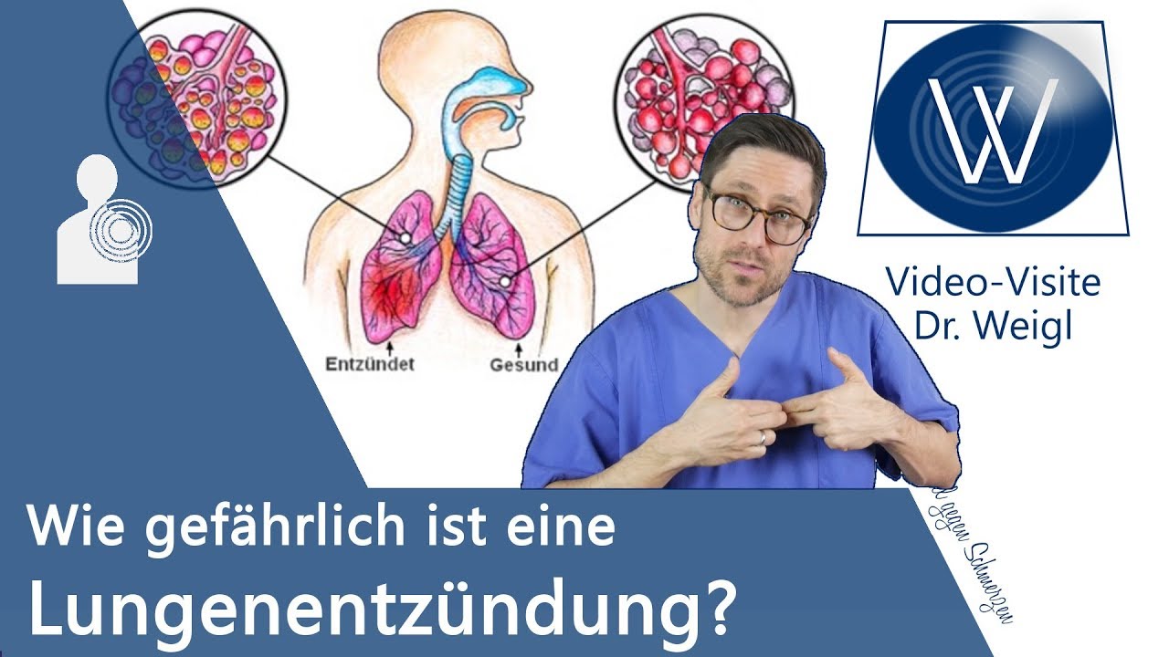 Lungenentzündung: Wie gefährlich ist die Pneumonie? Hygiene & Prophylaxe sowie Symptome & Therapie❗