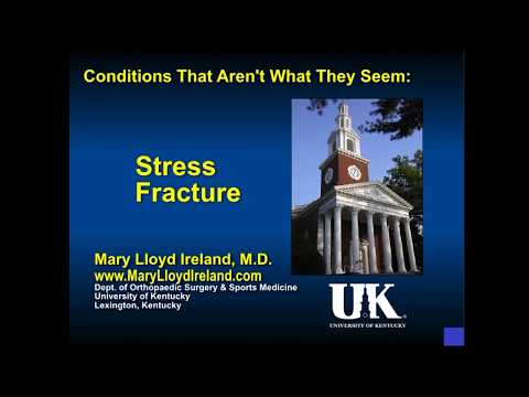 611 Stress Fracture: Conditions that Aren't what they seem