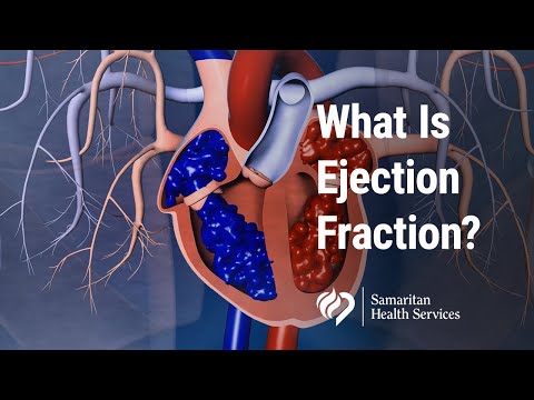 What Is Ejection Fraction?