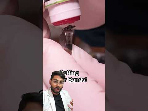 NEW BANDING PROCEDURE??? Band lok #braces #smilecare #aesthetic #smile #dentist #orthodontist