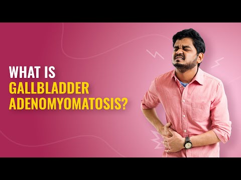 Gallbladder Adenomyomatosis: Symptoms, Causes, and Treatment Explained | MFine