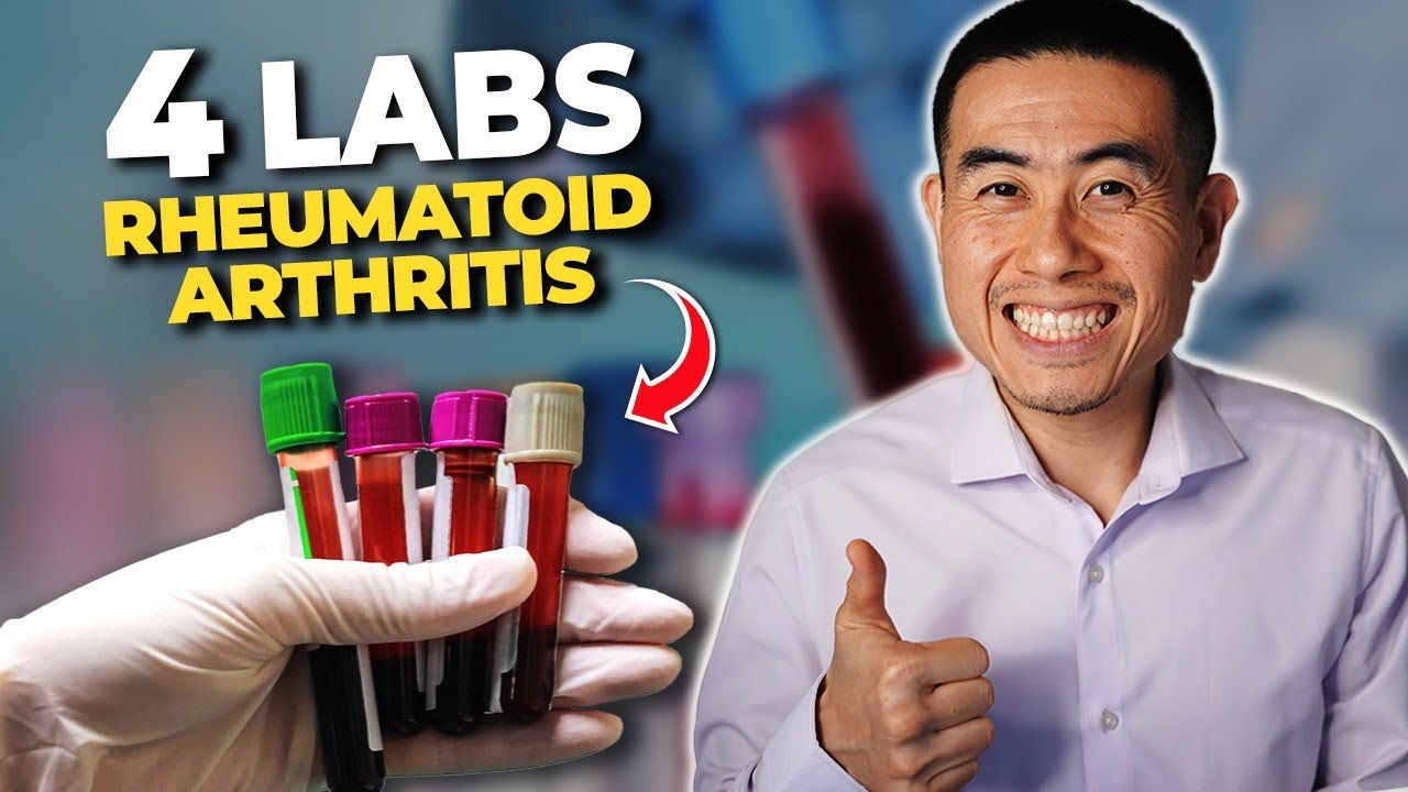 4 Rheumatoid Arthritis LABS that you Need to Know! | Rheumatologist Dr. Micah Yu