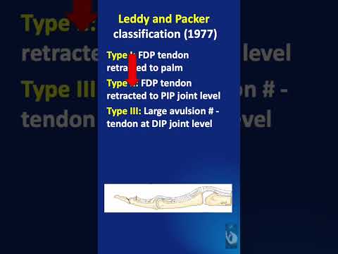Shorts # 153: Classification of FDP avulsion injuries- Jersey finger - Leddy & Packer Classification