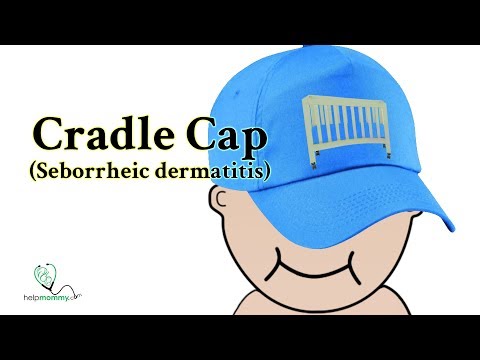 What is cradle cap? What can I do for cradle cap?