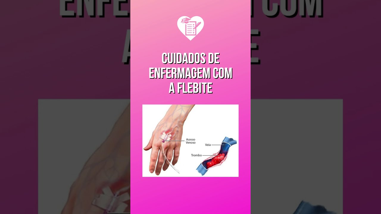 CUIDADOS DE ENFERMAGEM COM FLEBITE #shorts