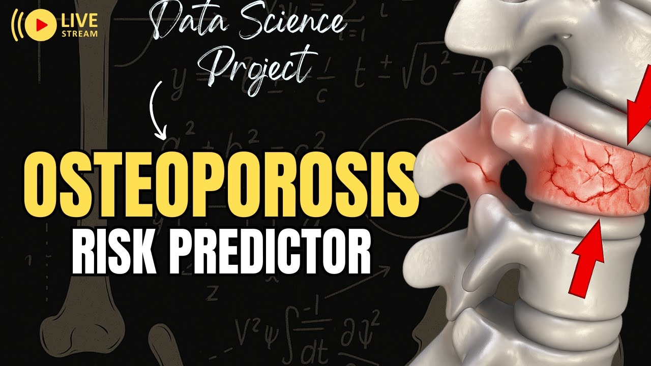 Project : OSTEOPOROSIS Risk Prediction - Data Science Project  | LIVE