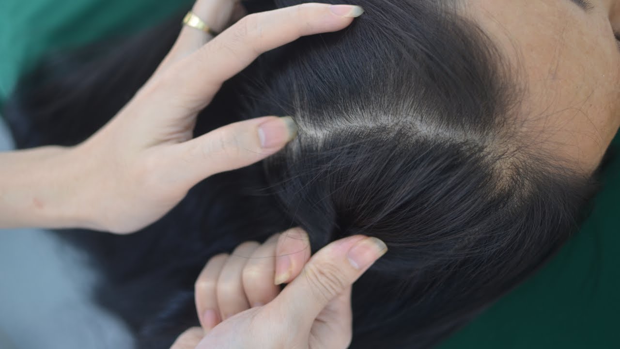 ASMR Hair Pulling, Hair Parting, Real Person Scalp Scratching Massage For Relaxation