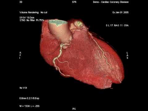 CTA Scan: Video Example