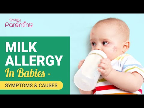 Milk Allergy in Babies - Causes and Signs