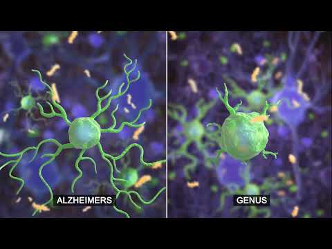 MIT Scientists Reveal Brain Rhythm Role in Alzheimer’s Research