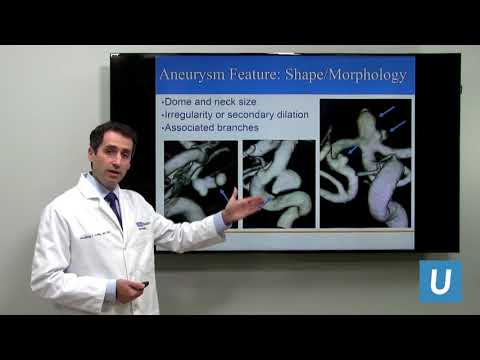 Brain Aneurysms: The Basics | Geoffrey Colby, MD | UCLAMDChat