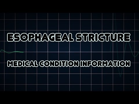 Esophageal stricture (Medical Condition)