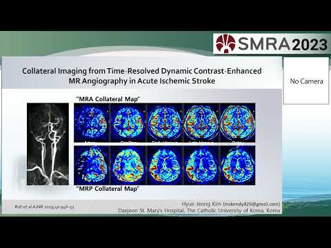 Educational Session 2 - Intracranial and extracranial carotid MRA - Bum-Soo Kim