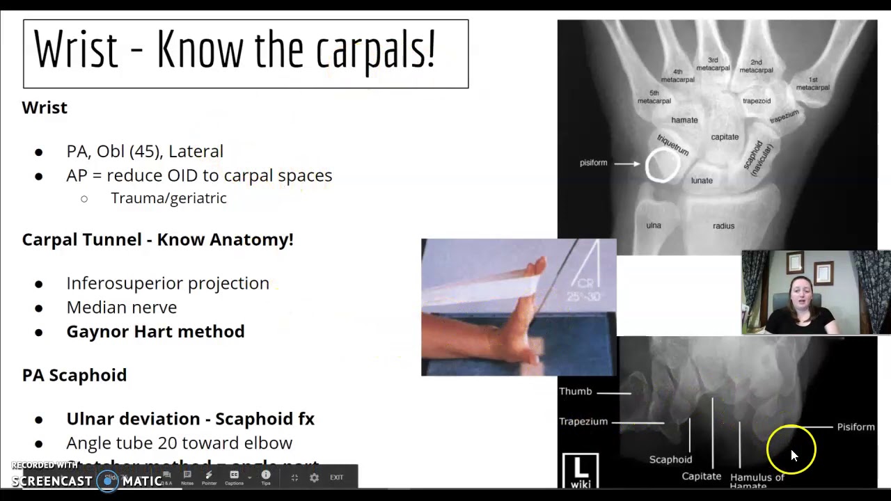 ARRT Procedures part # 9 - upper extremity