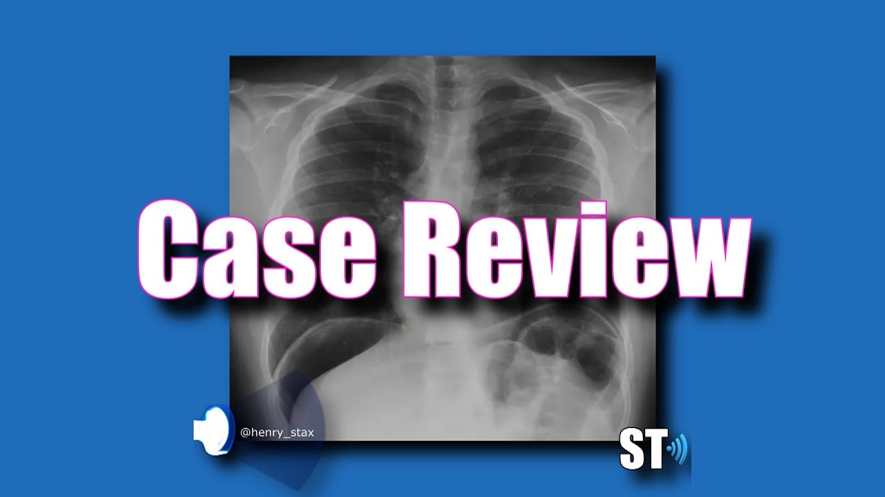 Case Review - Pneumoperitoneum
