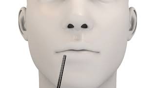 Endoscopic Endonasal Approach (EEA) to Skull Base | Stanford Health Care