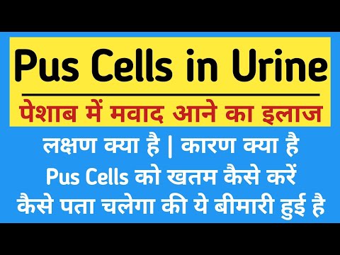 Pus Cells in Urine in hindi | पेशाब में मवाद के लक्षण, कारण, इलाज, क्या खाएं | Pus Cells खतम करें