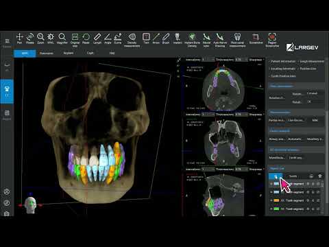 AI teeth segmentation Intelligent AI function Software - SmartVPro✨All with just a few clicks!