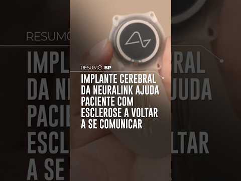 Implante cerebral da Neuralink ajuda paciente com esclerose a voltar a se comunicar | Resumo BP