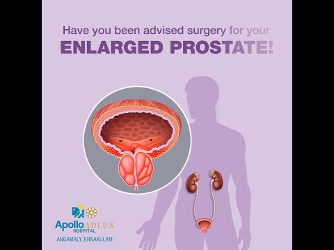 Laser Prostate Surgery | Apollo Adlux