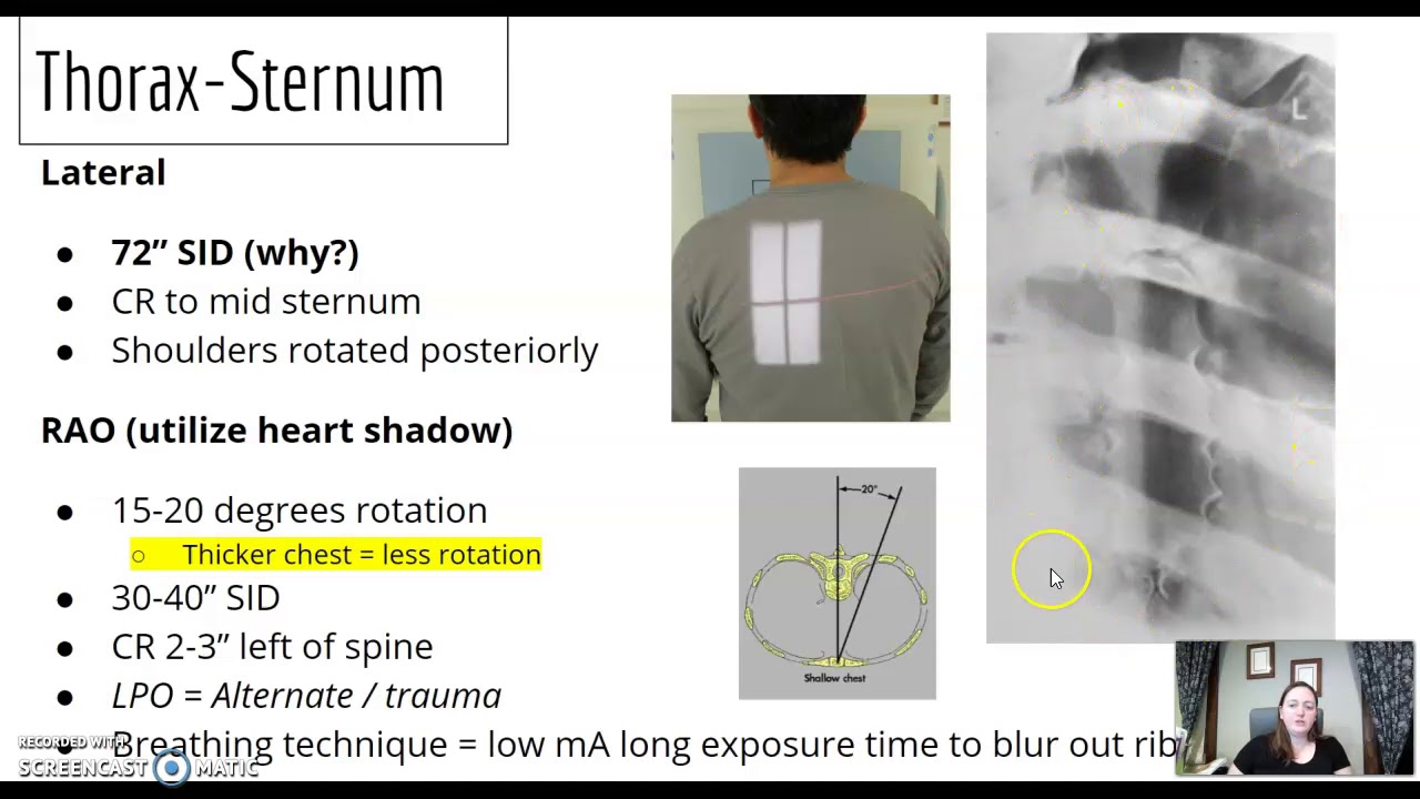 ARRT Procedures part # 4- Chest & Abdomen