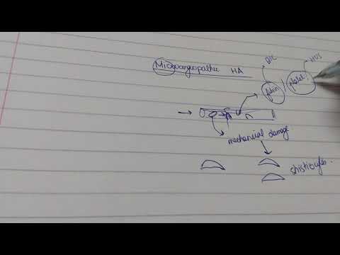 Microangiopathic Hemolytic Anemia