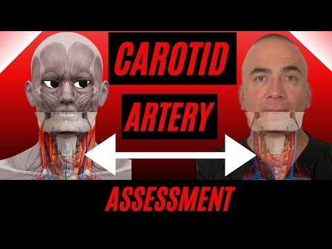 Carotid Pulse Assessment for Nurses | How to assess, and where are the Carotid Arteries?