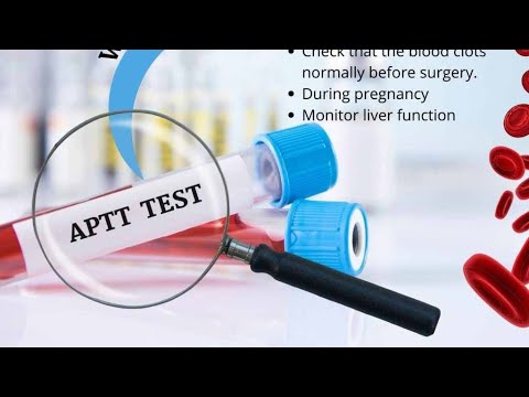 DETERMINATION OF APTT /CLOTTING FACTORS/HEMATOLOGY/HEMATOPOISES #PATOLOGY