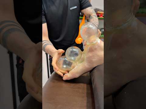 "ASMR"vip cupping alinezhad#asmr #shorts #viralshort #viralshorts #cupping #fire #massage #fyp