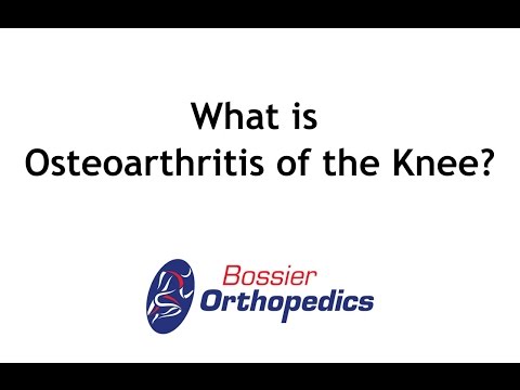 What is Osteoarthritis of the Knee? - Willis Knighton Health